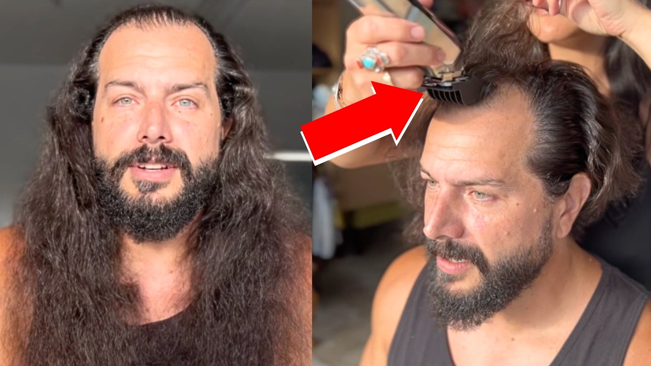 BALDING MAN Documents SHOCKING! Hair TRANSFORMATION *Wholesome* - YouTube