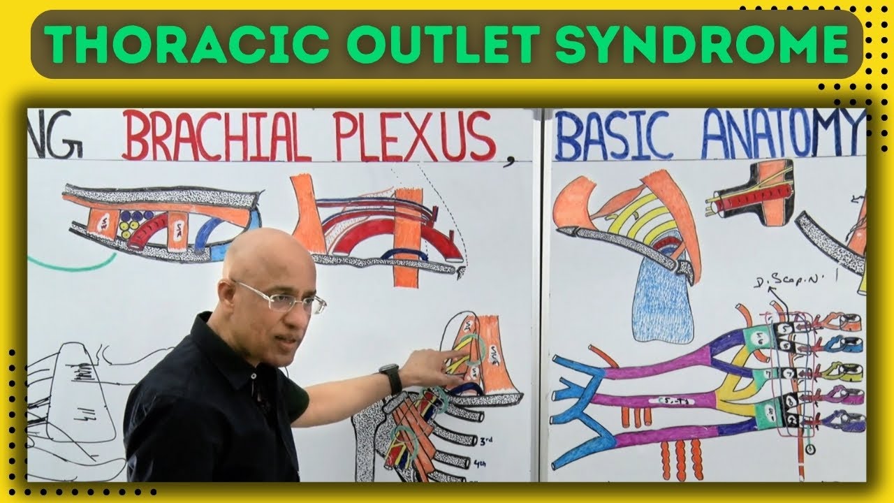 Thoracic Outlet Syndrome | TOS | Anatomy - YouTube