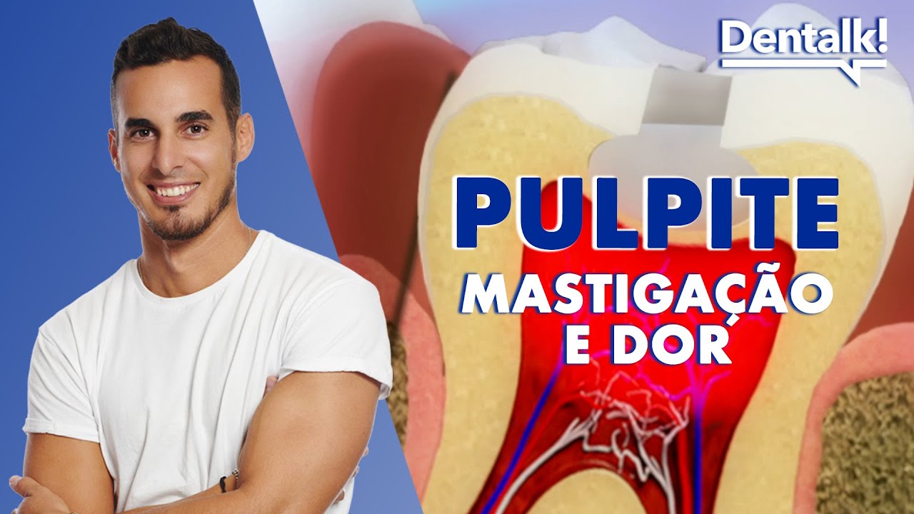 Dor de dente intensa? Poderia ser PULPITE - Tratamento de INFLAMAÇÃO da ...