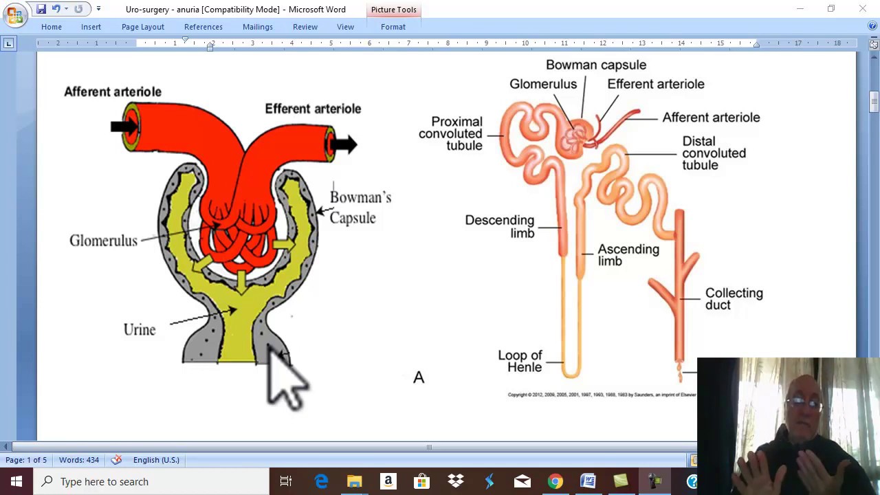 Urology 16 ( Anuria ) , by Dr. Wahdan . - YouTube