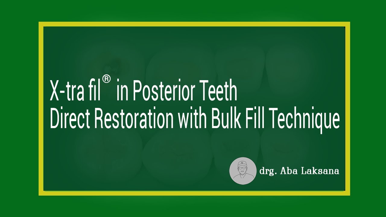 X-tra Fil® Bulk-Fill (86 % w/w) Composite Resin for Posterior ...