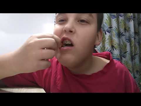 takis vulcan - YouTube