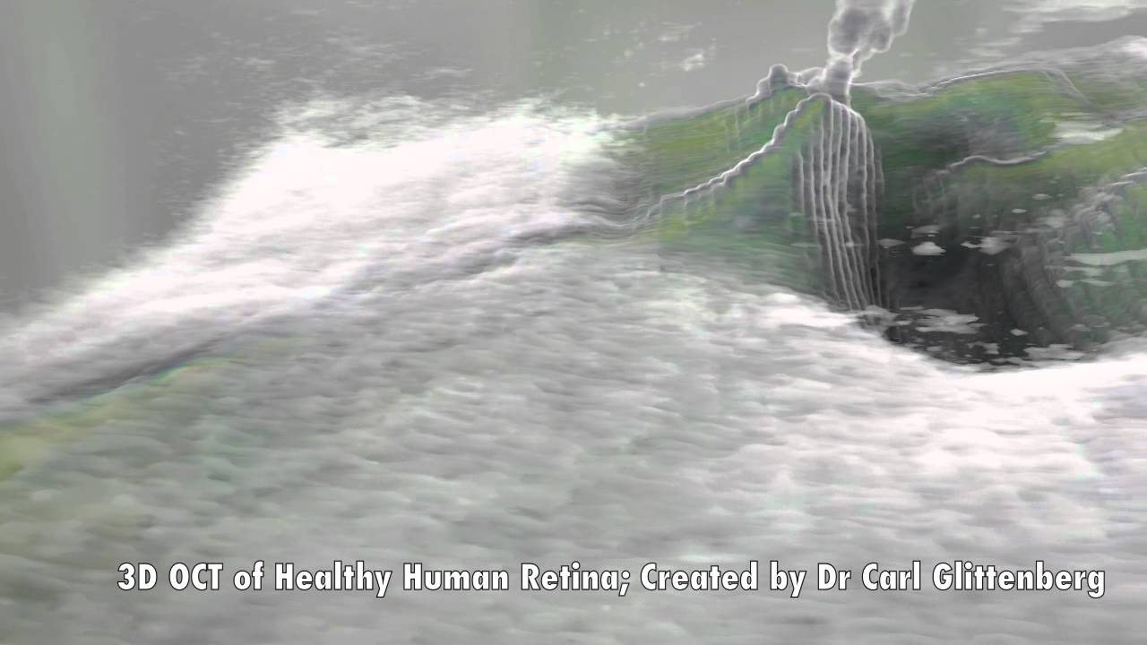 3D OCT of Healthy Retina - YouTube