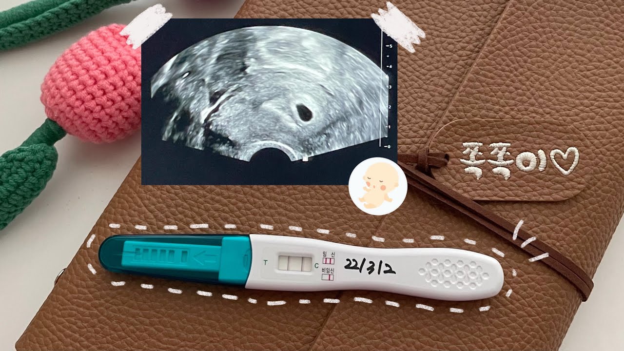 Vlog 여러분 오랜만이에요 저에게 아기천사가 찾아왔어요👼 임밍아웃ㅣ입덧지옥ㅣ임산부 생활 시작ㅣ임신ㅣ임신브이로그ㅣ아기집 초음파ㅣ임테기 변화ㅣ흑호랑이띠아기ㅣ