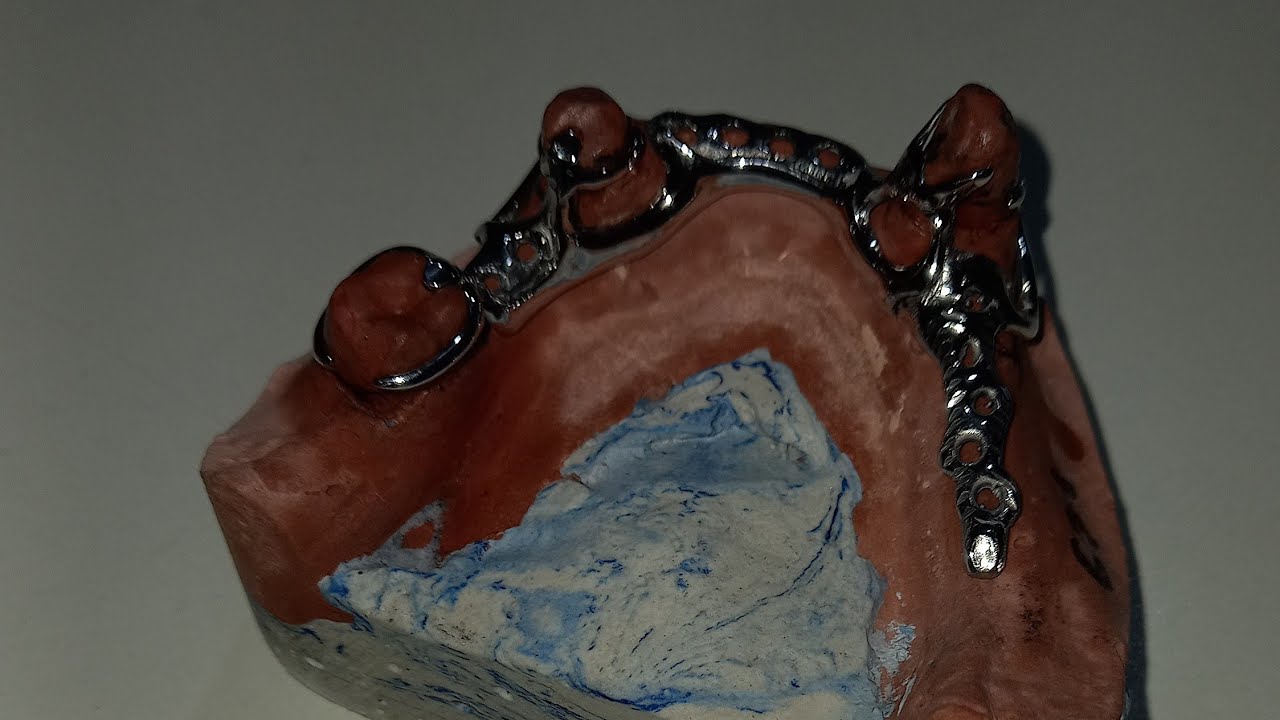 polimento estrutura metálica ppr Zap 11 98391-0468 - YouTube