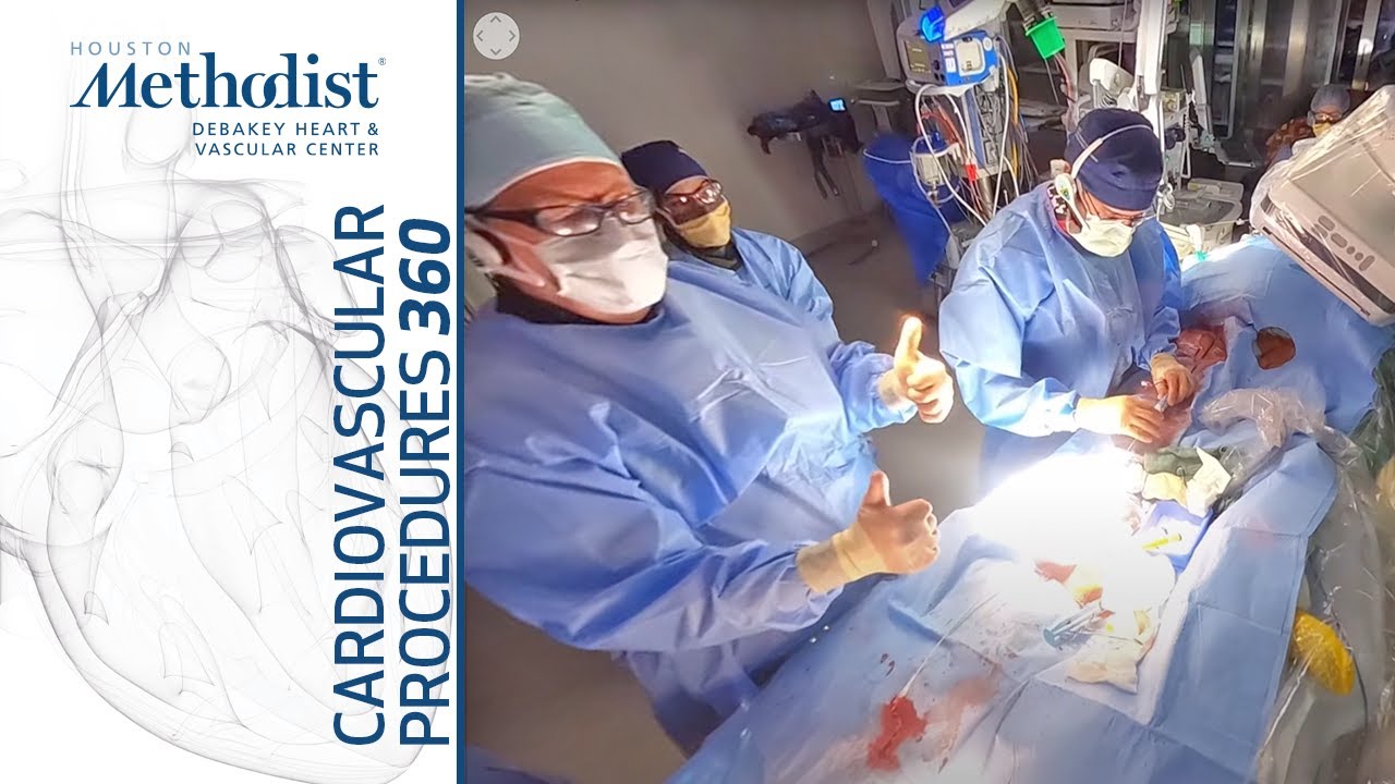 Superior Mesenteric Artery Stenting—360 video (Alan Lumsden, MD; Trisha ...