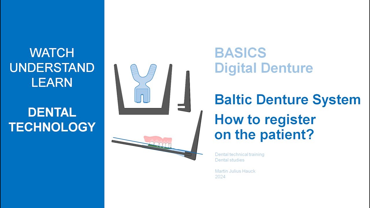 Baltic Denture System | How to register on the patient? - YouTube