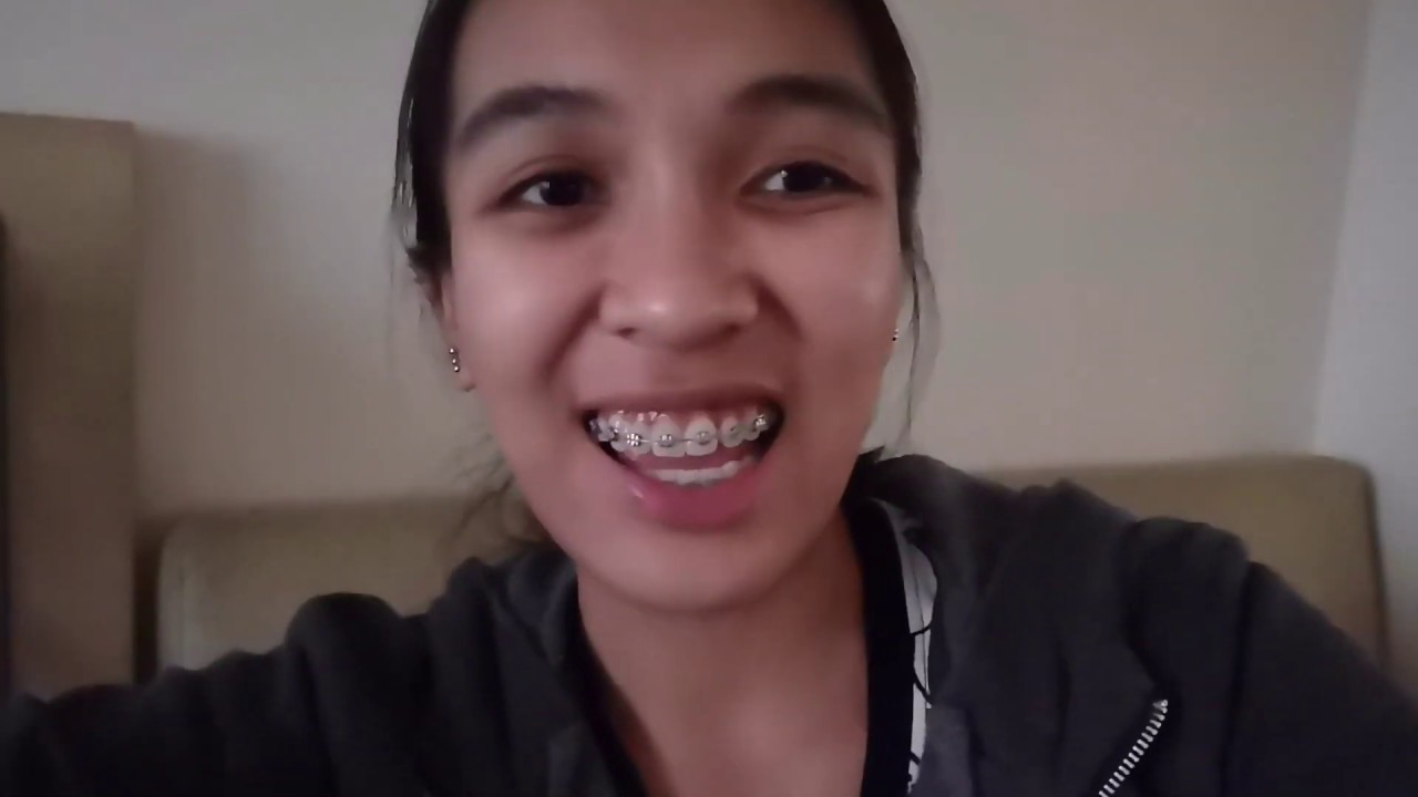 Braces and Splint: For TMJ Problem - YouTube