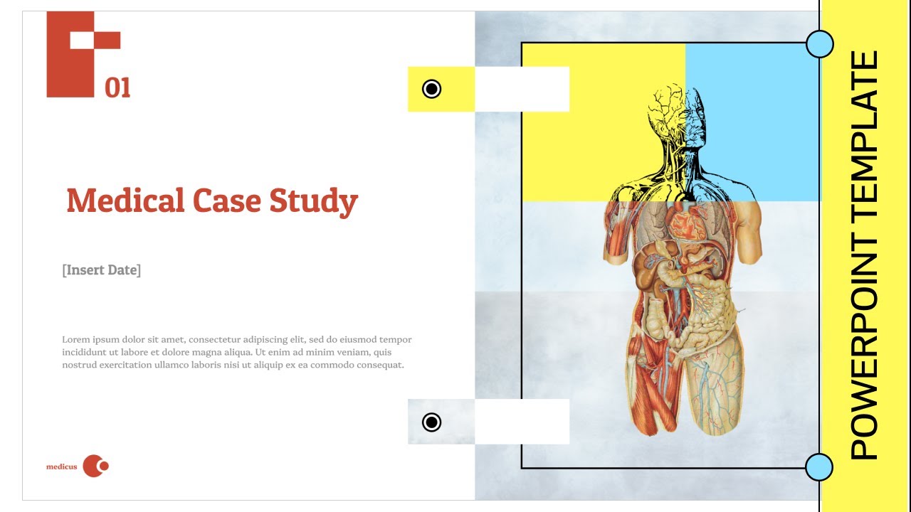 Medical Case Study Presentation | Download PowerPoint Template | O J ...