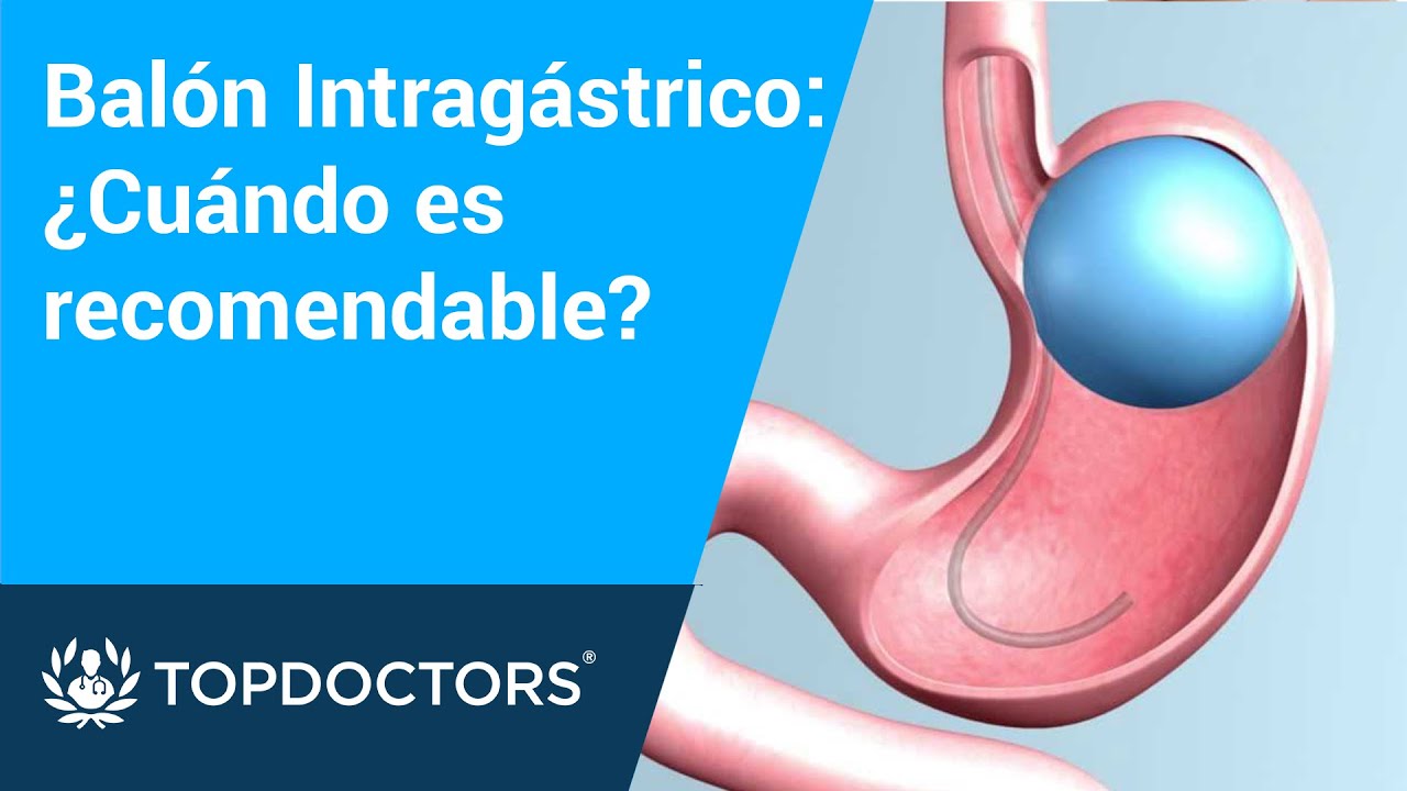 Balón Intragástrico: ¿Cuándo es recomendable?- Dr. Fabián Enrique Valle ...