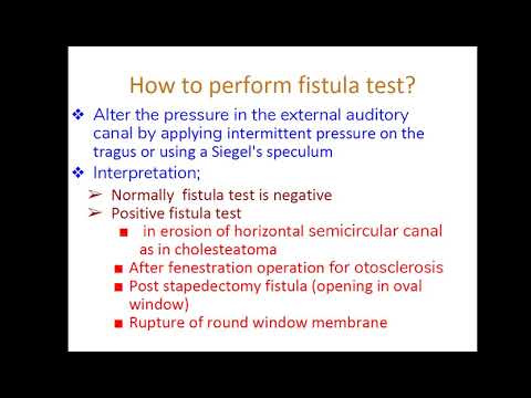 Fistula test and Hennebert's sign - YouTube
