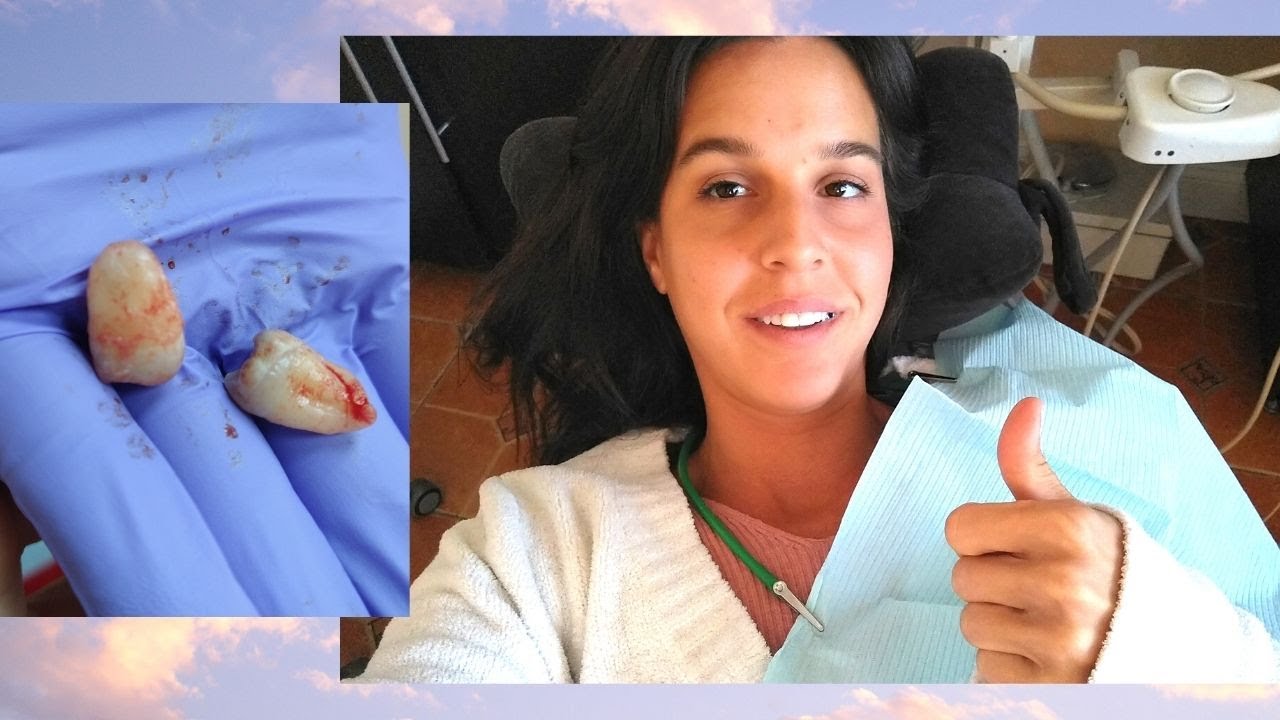 My PAINLESS Wisdom Tooth Extractions & Funny Sedation Clips - YouTube
