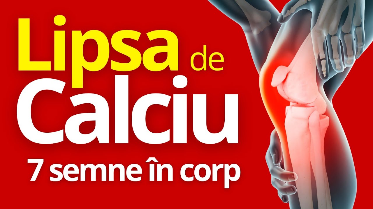 Lipsa de CALCIU: 7 semne de alarmă - YouTube