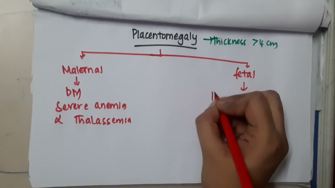 placentomegaly II obstetrics mp4 - YouTube
