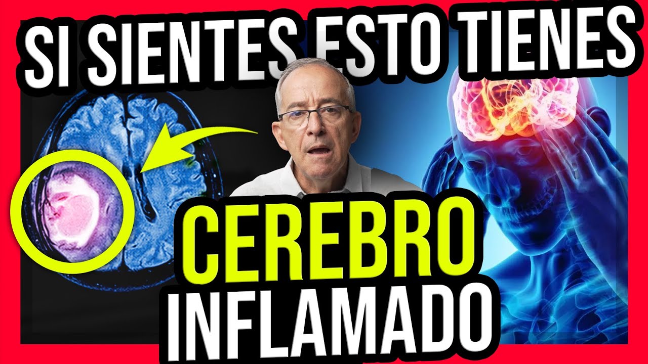 🧠 Que Es Eso Que LLAMAMOS Un CEREBRO INFLAMADO - Oswaldo Restrepo RSC ...
