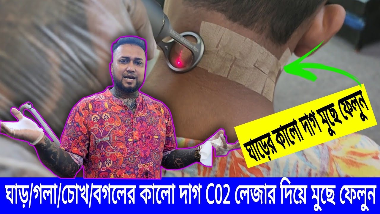 ঘাড়ের কালো দাগ দূর করা | garer kalo dag dur korar upay | how to get ...