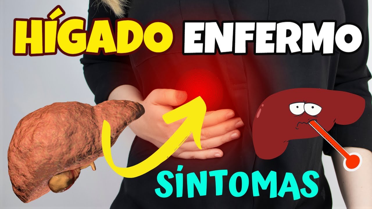 🔴El Hígado y Sus Síntomas Que Está Enfermo: Como evitar hígado ALTERADO ...