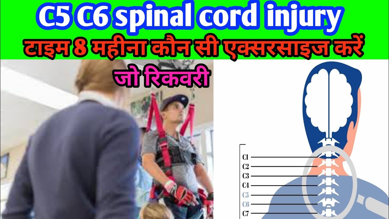 C5 C6 spinal cord injury\\cervical level spinal cord injury#sci#spinal# ...
