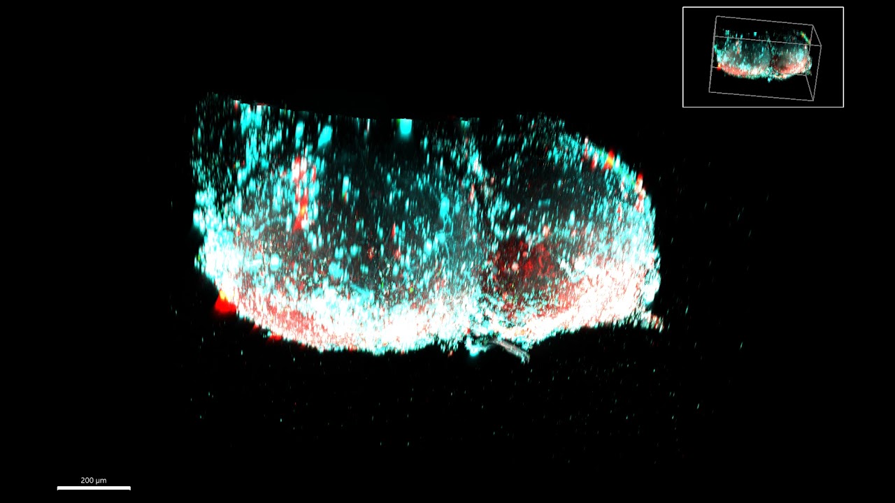MicroBrain Panel 3 - Organoids 3D IHC - YouTube