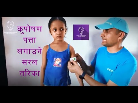 How to detect malnutrition using MUAC Tape - YouTube