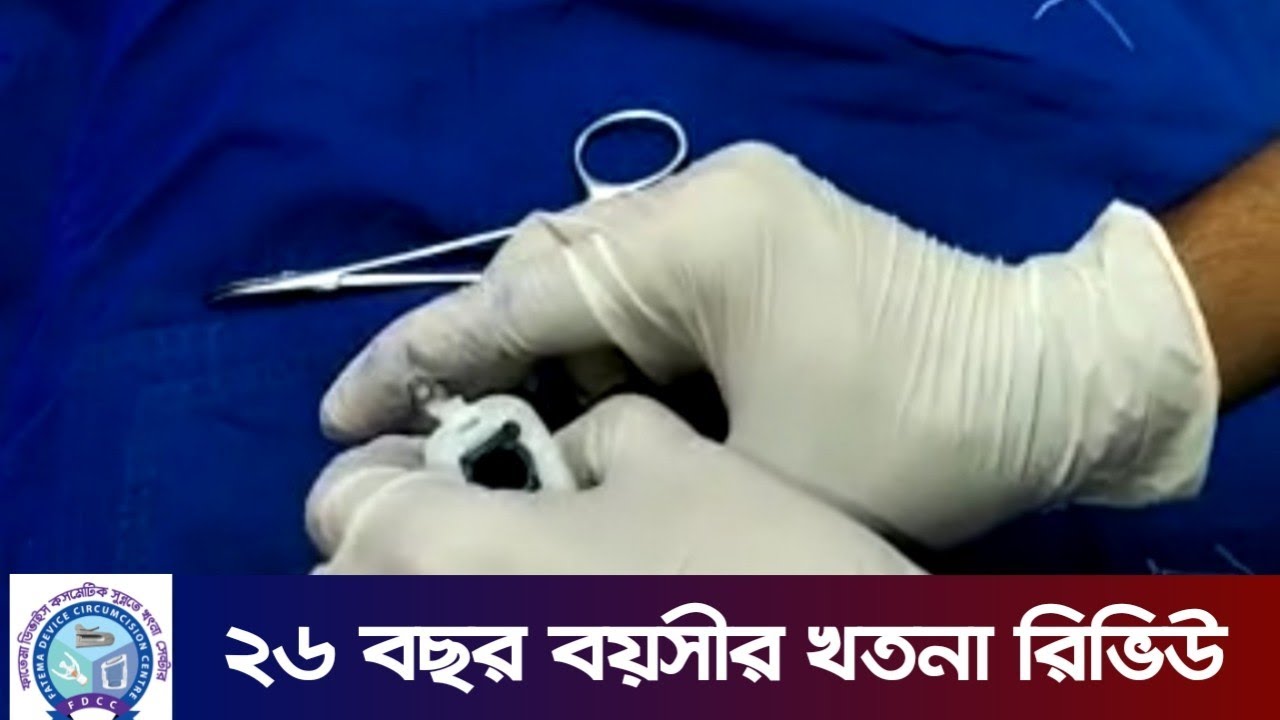২৬ বছর বয়সীর ডিভাইস কসমেটিক সুন্নতে খৎনা | খাতনার রিভিউ | Adult ...