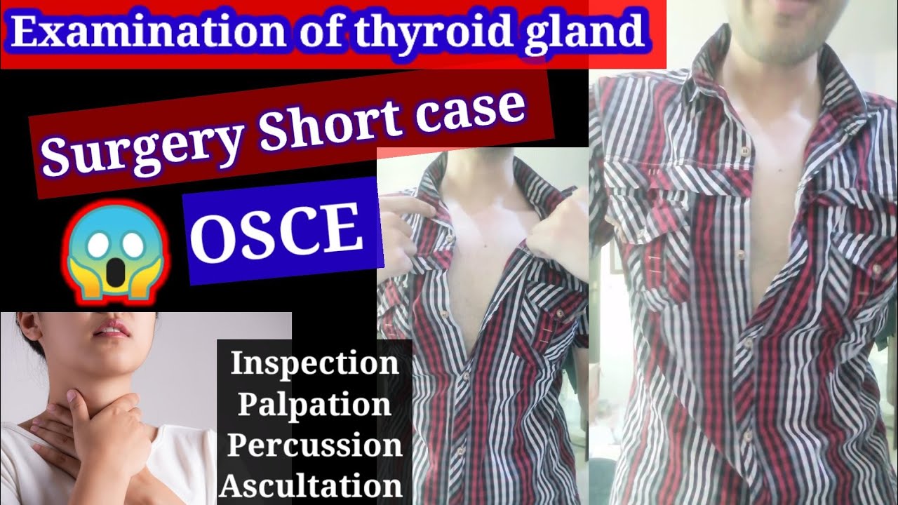 examination of thyroid gland #OSCE #OSPE #SURGERY SHORT CASES ...