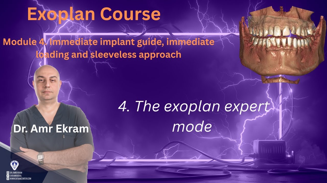 4 The exoplan expert mode - YouTube