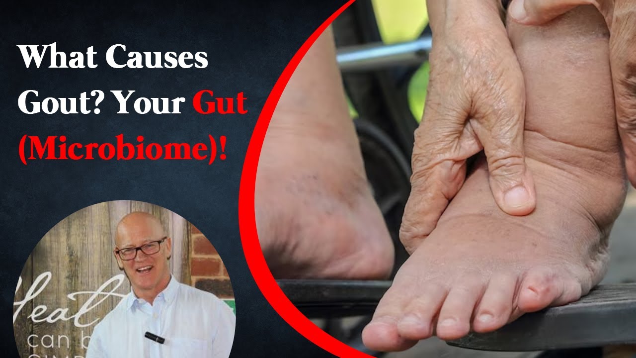 Is your gut health causing your gout? And how to fix it quickly. - YouTube