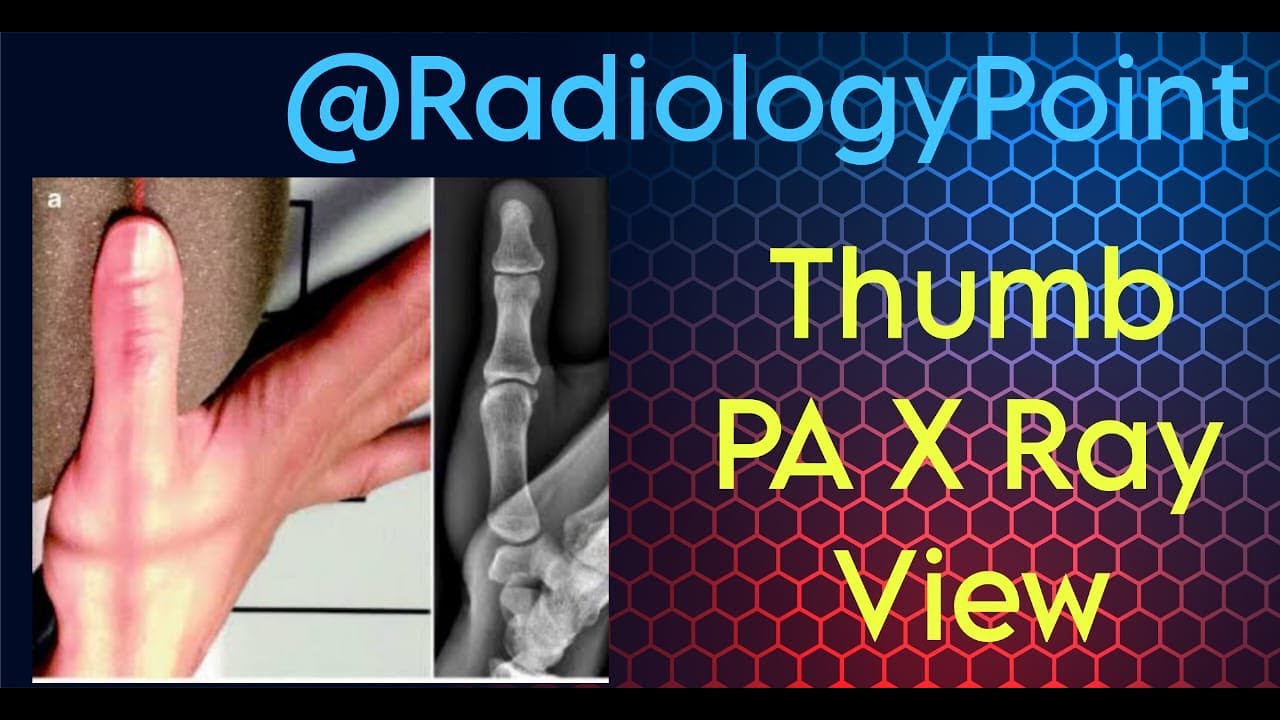 Thumb PA X Ray view | Digit Radiography | Hindi Explanation | at ...