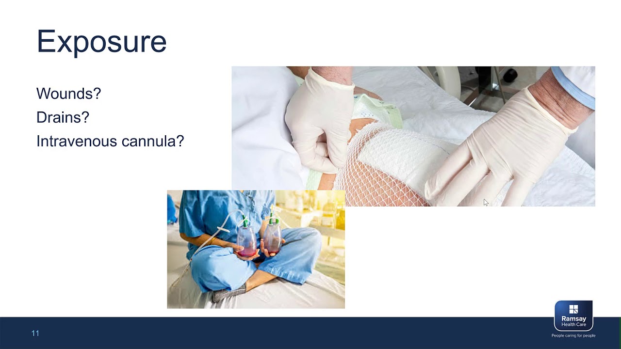 A To G Patient Assessment YouTube A To G Patient Assessment YouTube