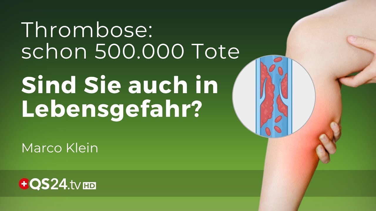 Wunderbar Thrombose Spritzen Oberschenkel Bild