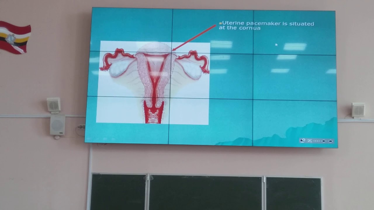 Abnormal uterine contractions - YouTube