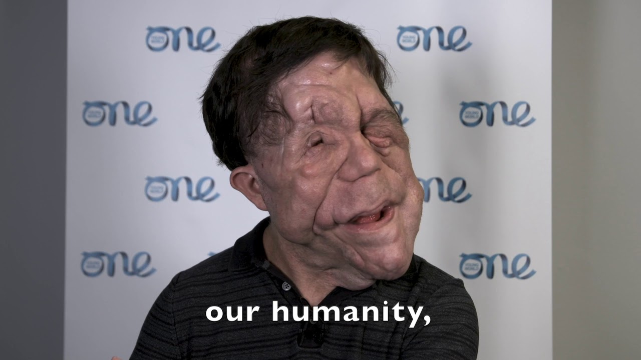 Adam Pearson on disability inclusion and representation - YouTube