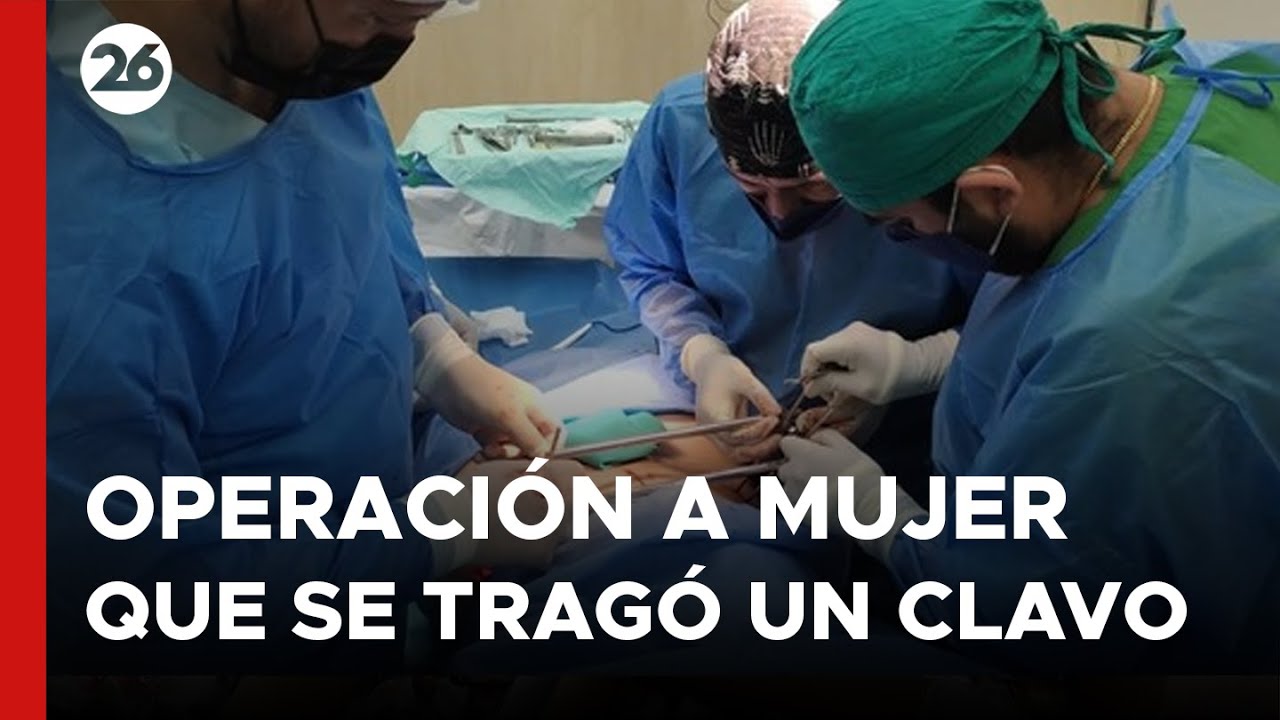 Médicos peruanos realizan una peligrosa operación a mujer que se tragó ...