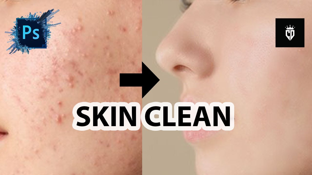 SKIN CLEAN | CLEAR SKIN | SKIN CLEAN KAISE KARE | PHOTOSHOP TUTORIA ...