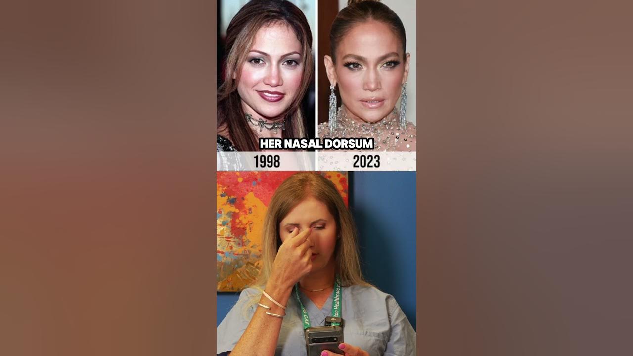 Has Jennifer Lopez Had Plastic Surgery? - YouTube