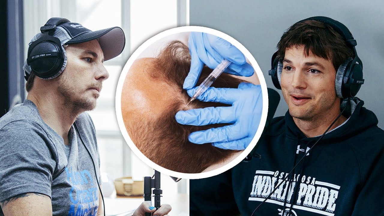 Dax Shepard Details His Finasteride Use And "Injections" To Keep His ...