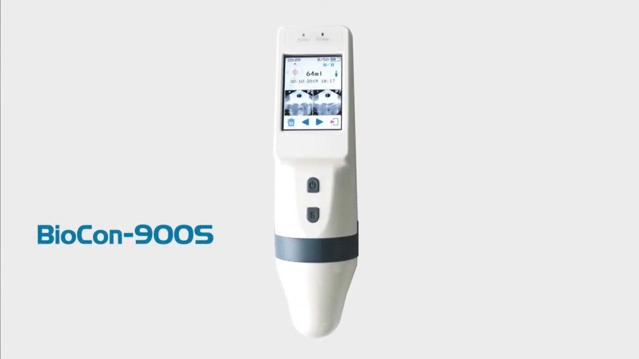 MCube BioCon 900S Bladder Scanner - YouTube