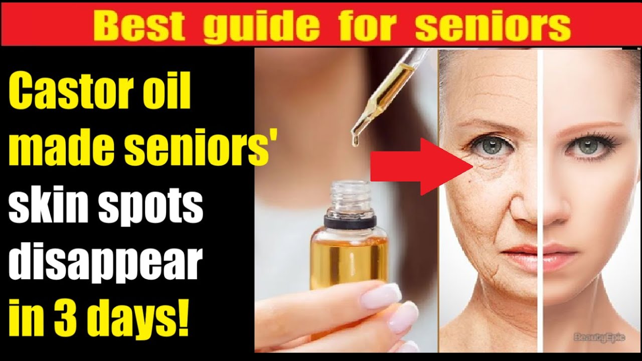 Doctors Revealed: Castor Oil Paste Removes Age Spots in 3 Days for ...
