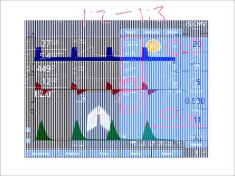 Inspiratory:Expiratory Time Ratio (I:E) - YouTube