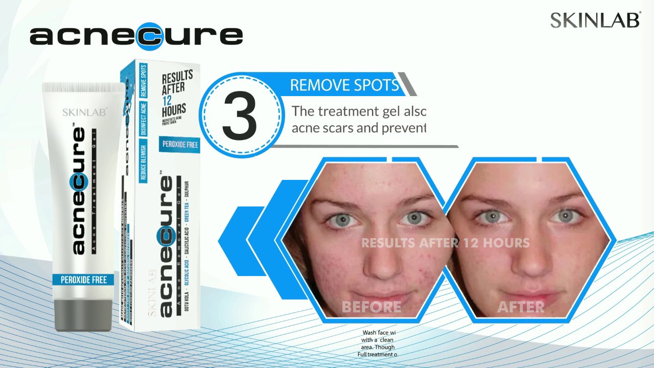 Acnecure - 12 hour acne treatment - YouTube