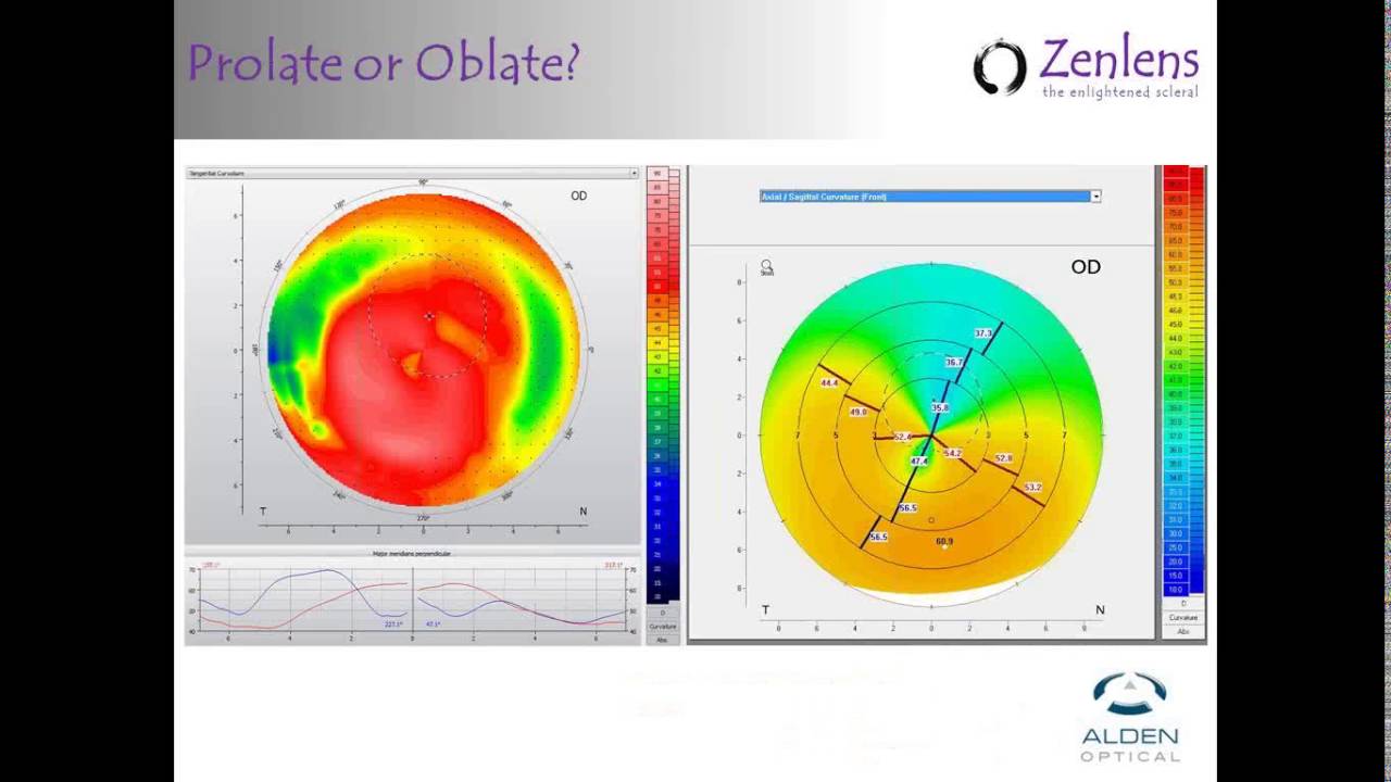 Zenlens Advanced Fitting - YouTube