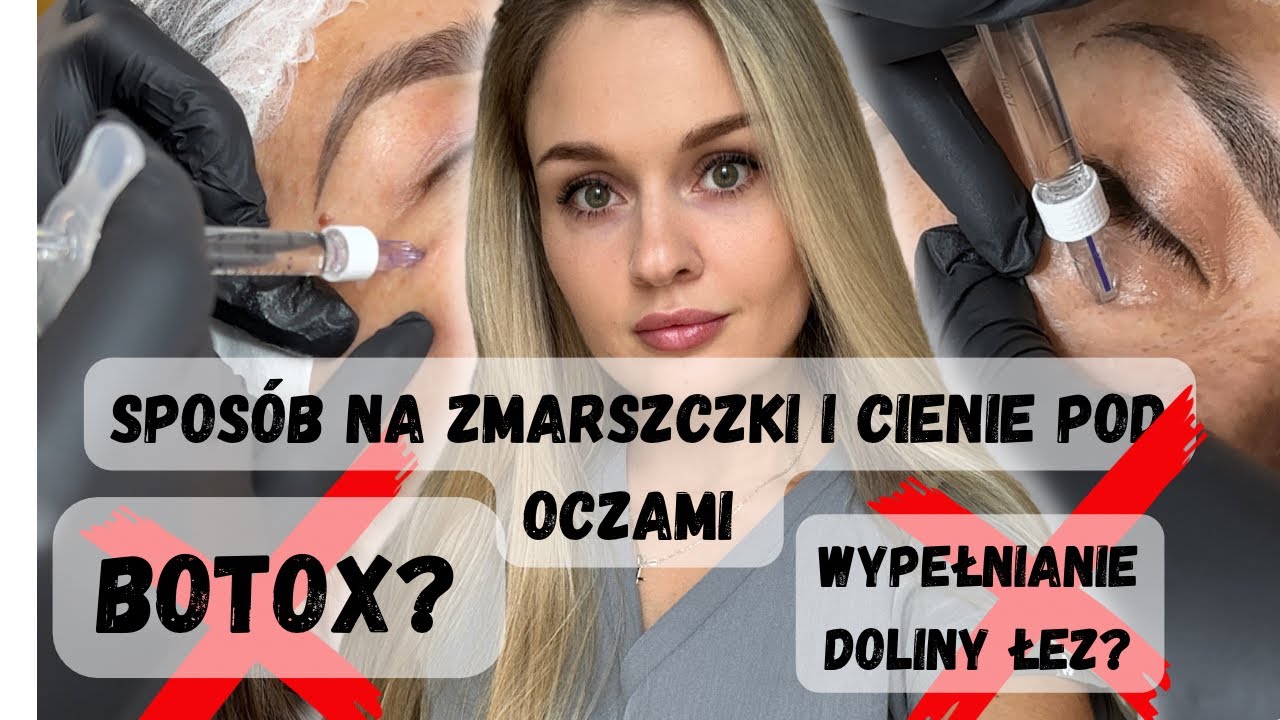 JAKI ZABIEG POD OCZY?👍 A JAKI NIE? 👎 CIENIE, ZMARSZCZKI I WORKI POD ...