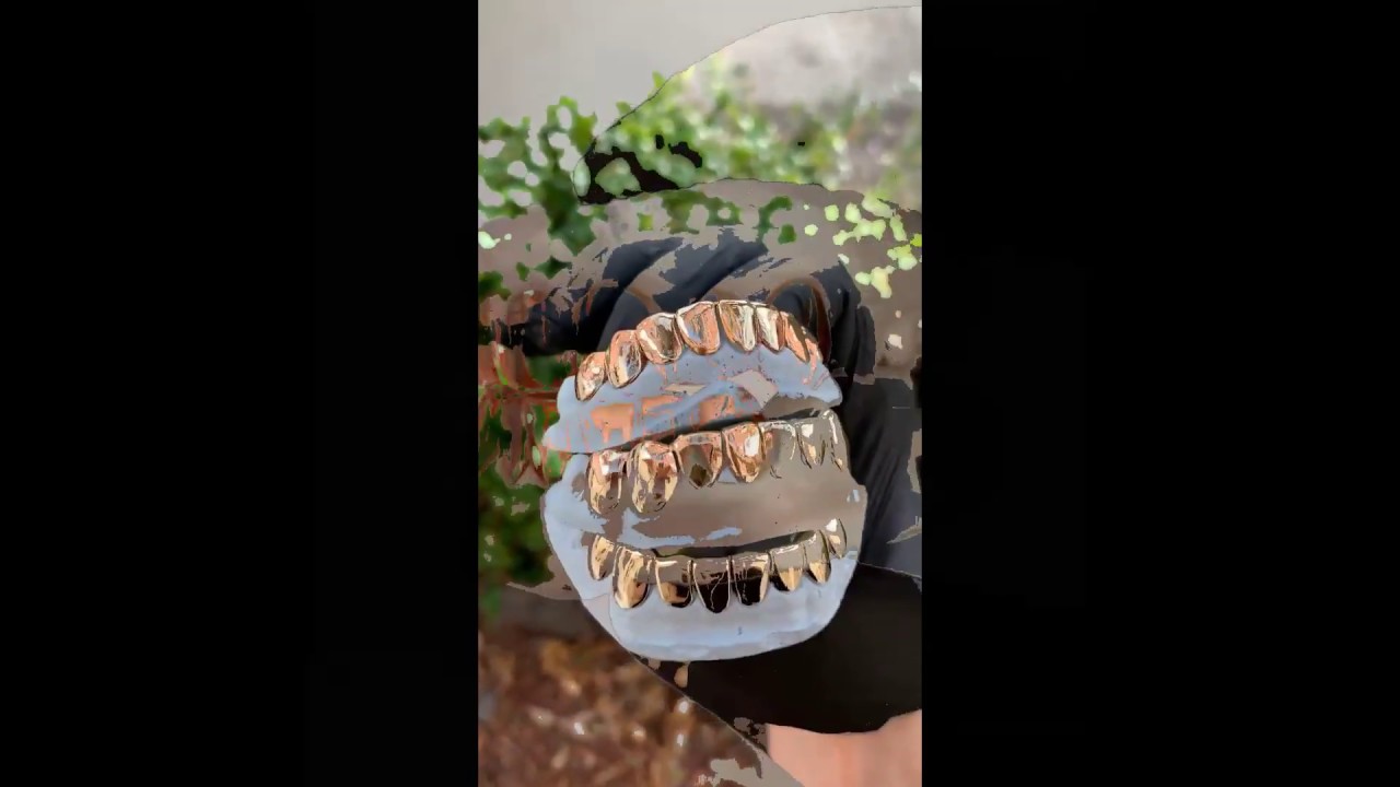 Custom Gold Grillz (Pull-Out) That Look Permanent by Benzino Jewelry ...