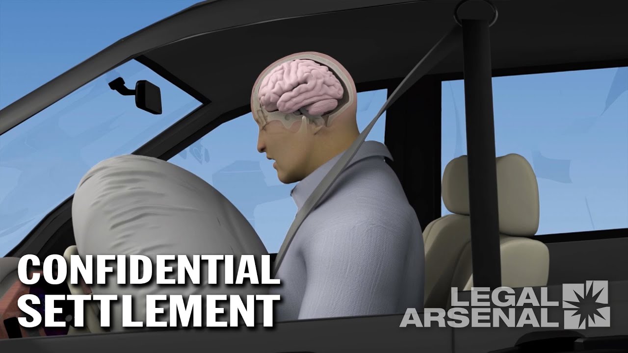 Traumatic Brain Injury: Acceleration and Deceleration (Whiplash) - YouTube