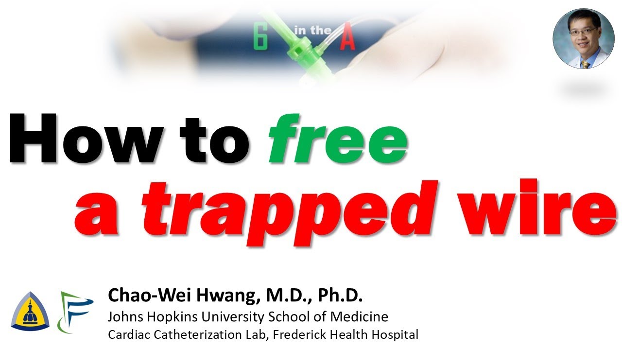 How to Free a Trapped Wire - YouTube