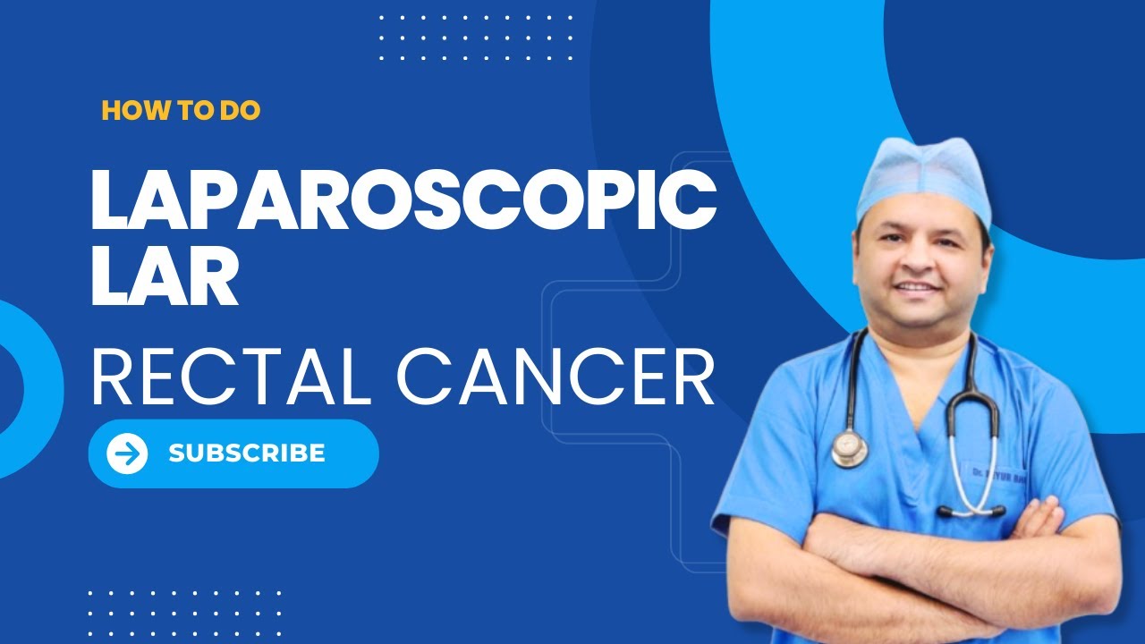 Cancer Rectum | Laparoscopic LAR - low anterior resection | Lap LAR ...