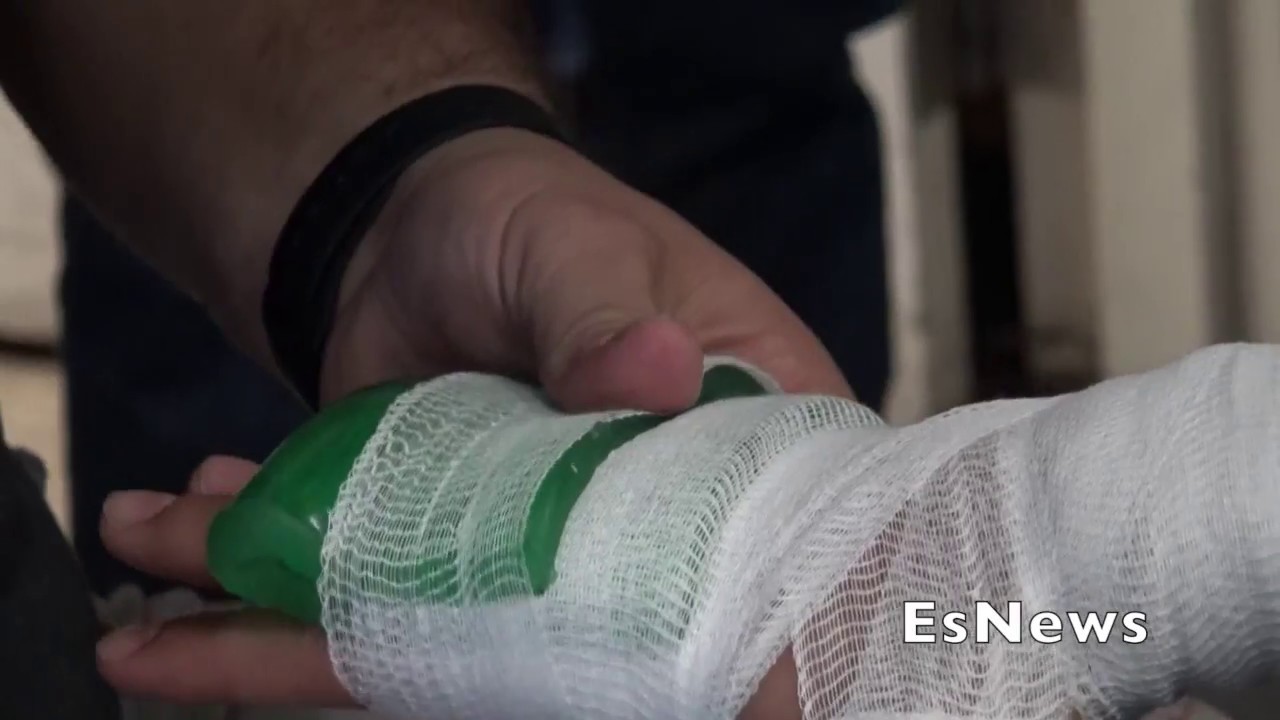 [Must See] No More Broken Hands New Hand Wraps Help Prevent EsNews ...