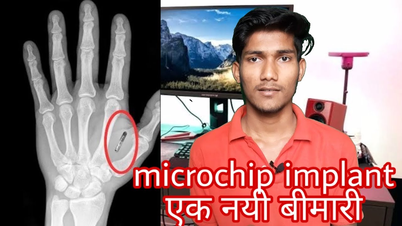 Microchip implant 😁😁👍👍 - YouTube