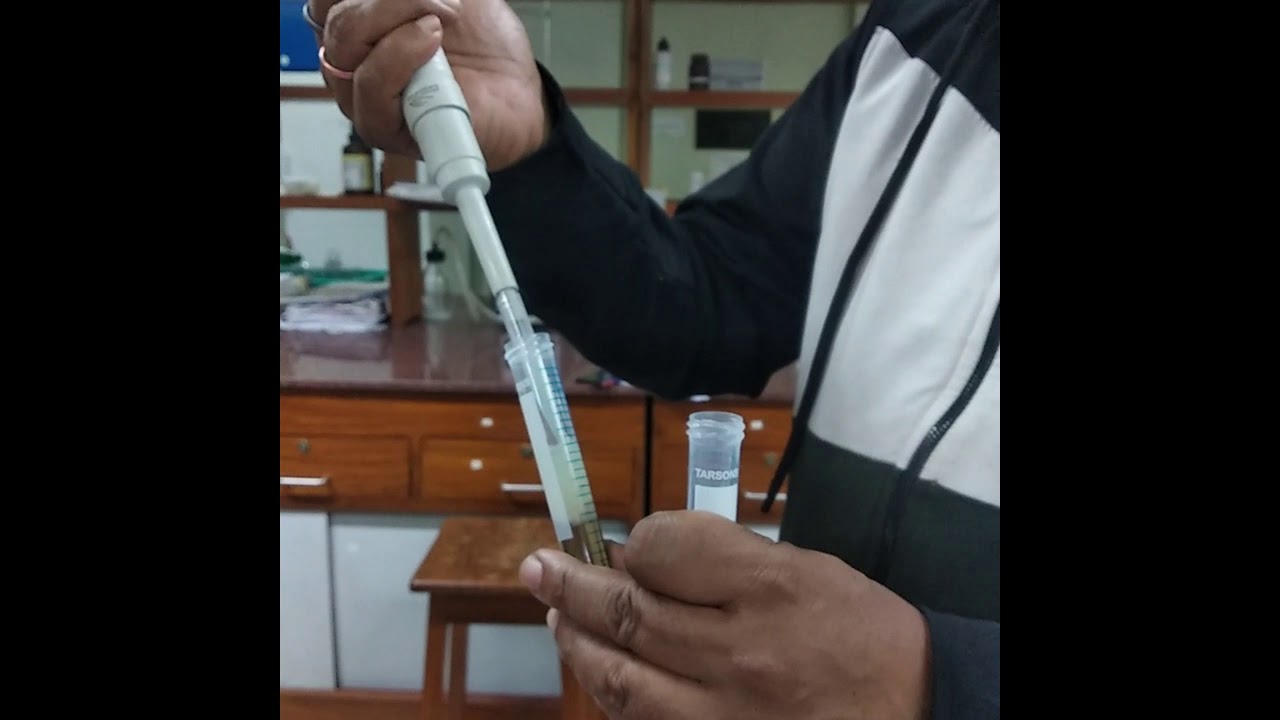 Isolation of Genomic DNA from mammalian Tissue - YouTube